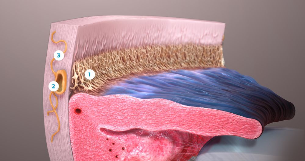 iTrack™ Canaloplasty